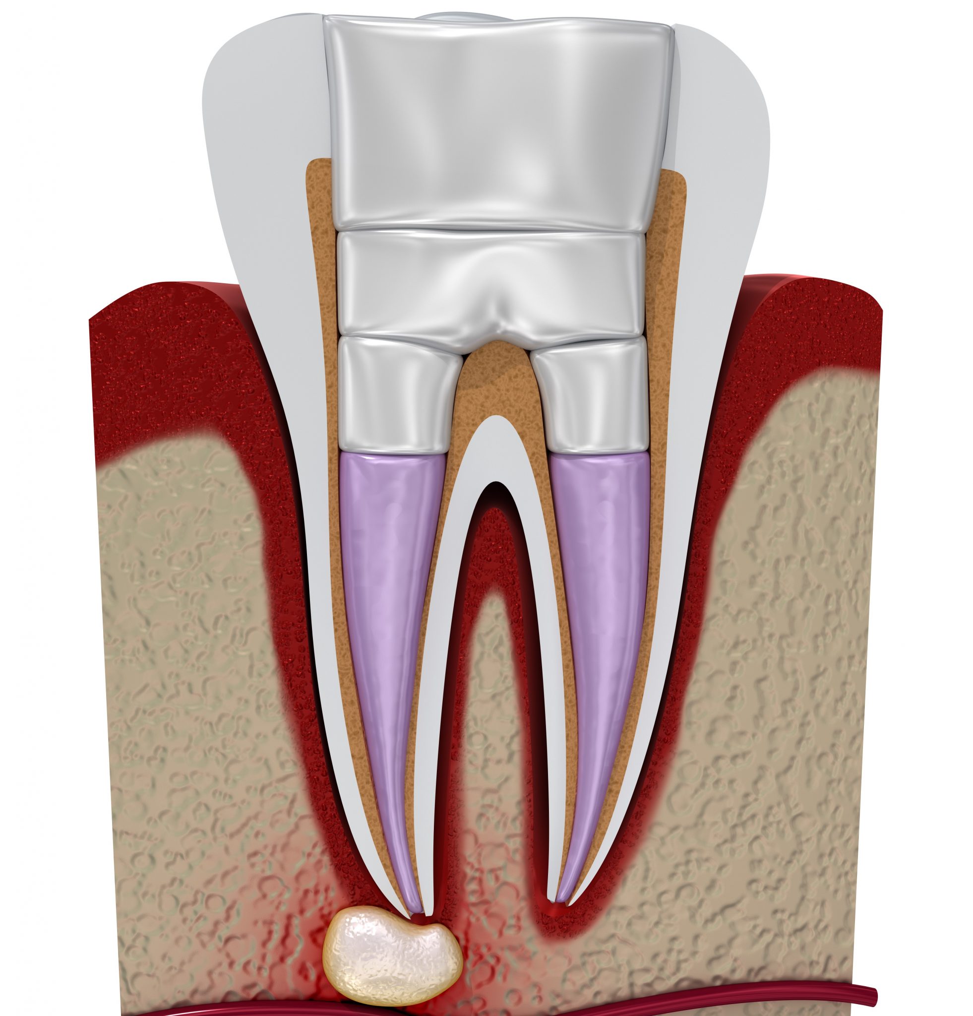 Leading Endodontics Clinic In Dubai | Best Root Canal Treatment In Dubai
