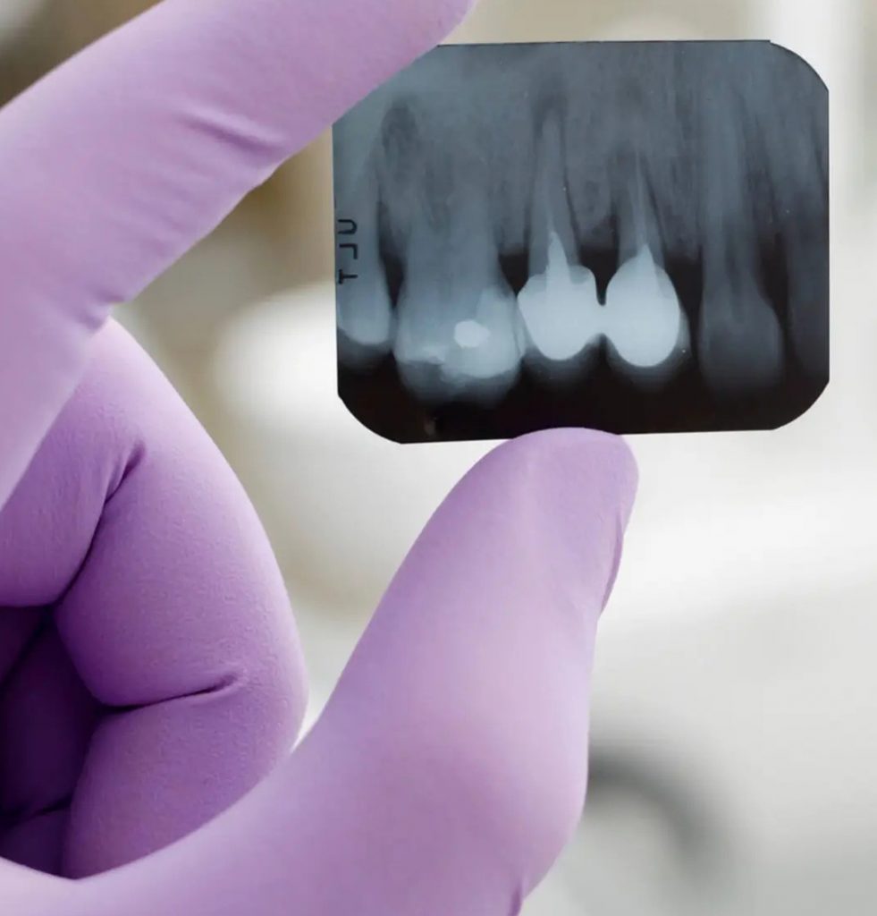 Dental Services in Al Barsha, Dubai | Klinika Dental Clinic