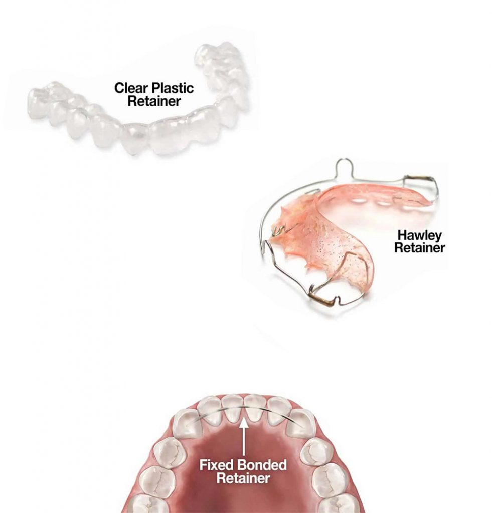 Best Orthodontist In Dubai | Klinica Dental Clinic