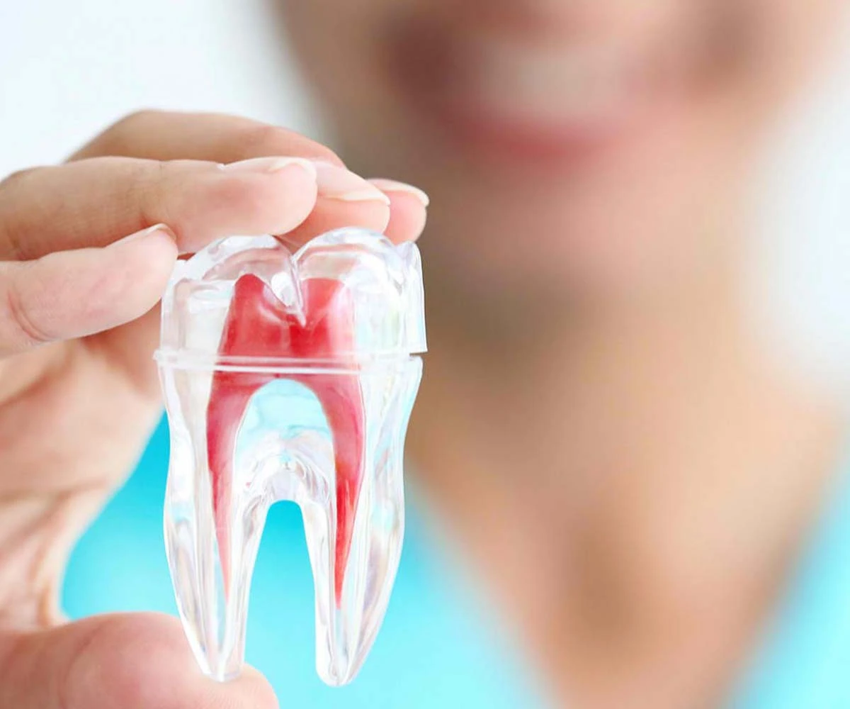 Root Canal Treatment: A Complete Guide - Klinika Dental Clinic Al Barsha